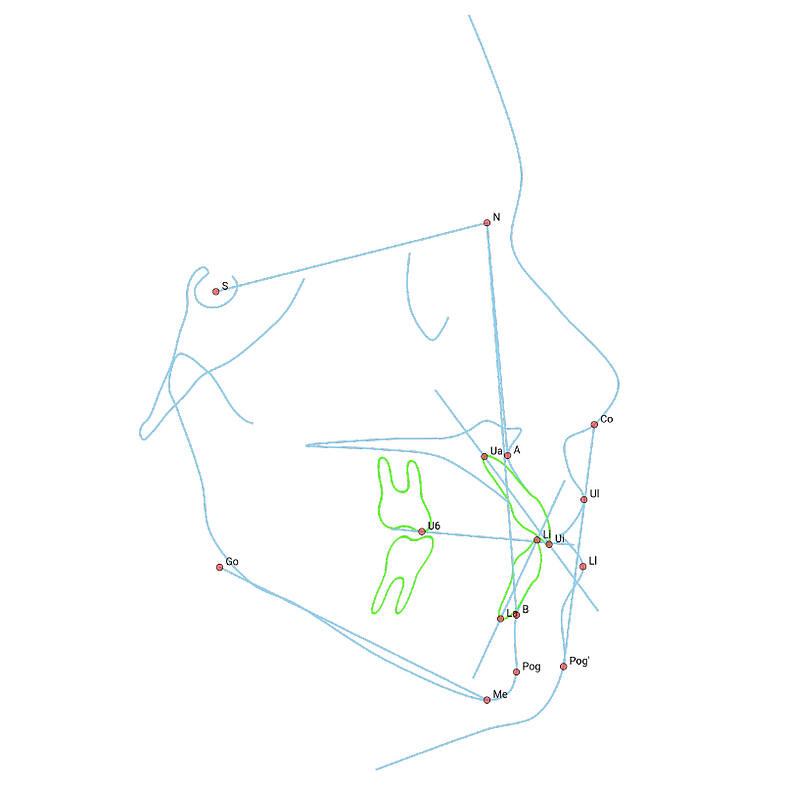 Analyse Céphalométrique en Tunisie - Smart Clinic