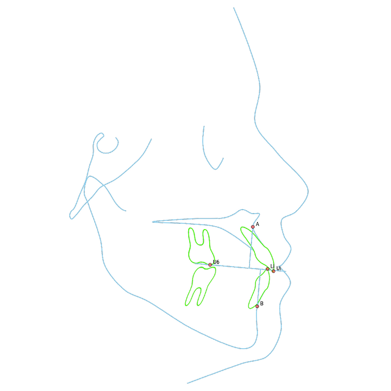 Analyse Céphalométrique en Tunisie - Smart Clinic